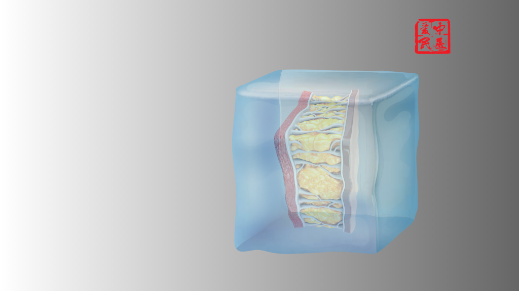 Fat Freezing for Weight Loss | Can Cryolipolysis Help You Lose Weight?