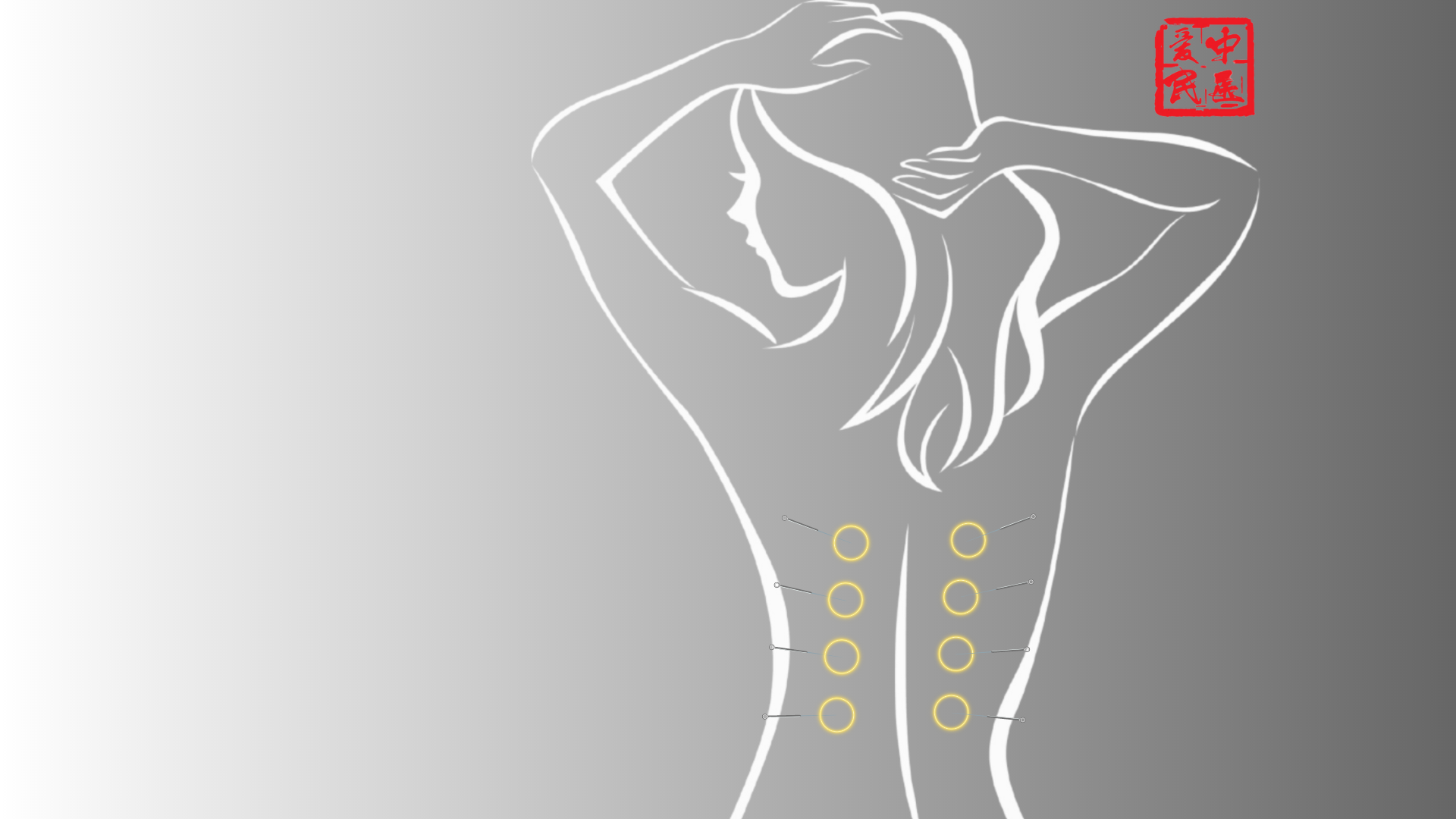 Acupuncture for Pain Management | Traditional Chinese Medicine