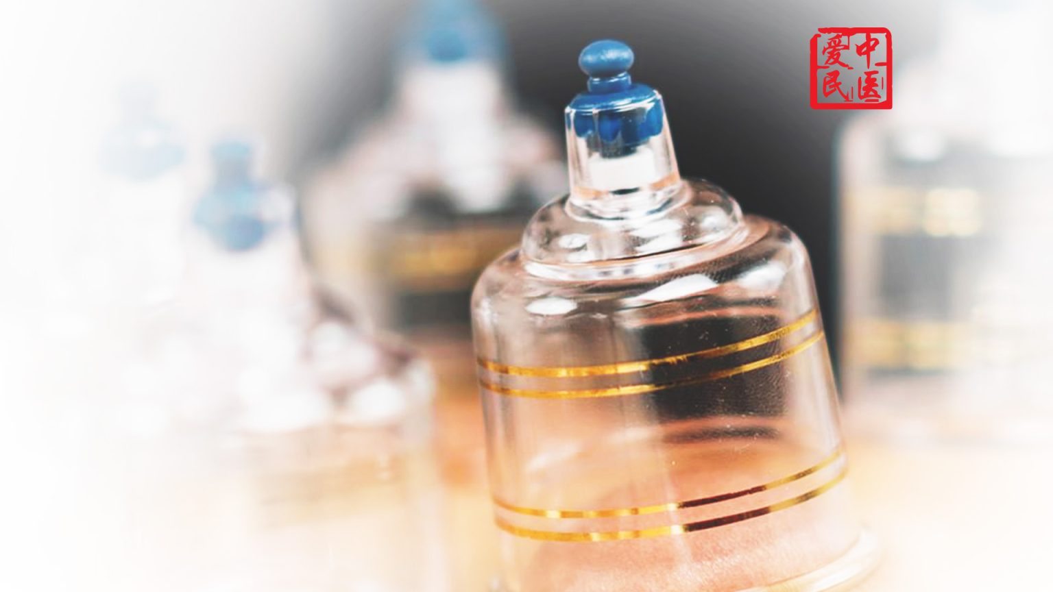 TCM Cupping for Weight Loss | Aimin