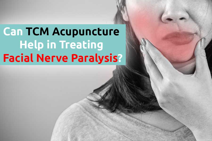 Can TCM Acupuncture Help in Treating Facial Nerve Paralysis?